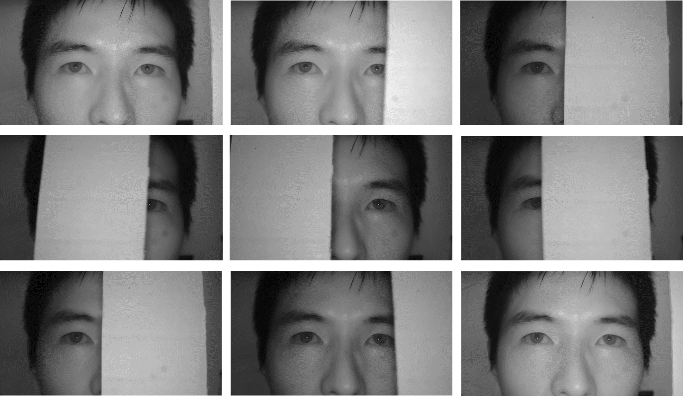 Video Dataset Based on Automated Cover Tests for Strabismus Evaluation ...